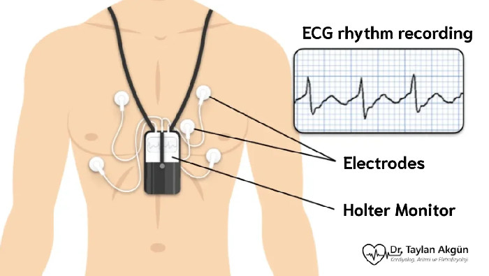 Holter :: Estudiante-iq-KarinaGonzález